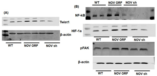 Silencing the Adipocytokine NOV: A Novel Approach to Reversing ...
