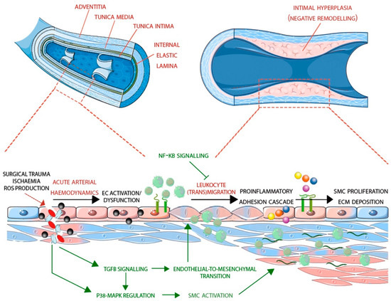 Cells | Free Full-Text | The Role of Endothelial Cells in the Onset ...