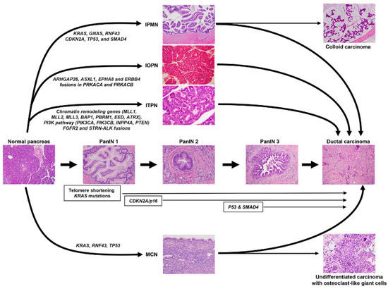 Pancreatic Ductal Adenocarcinoma: Molecular Pathology and Predictive Biomarkers