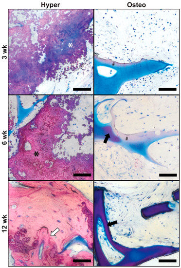 Effects of Endochondral and Intramembranous Ossification Pathways on ...