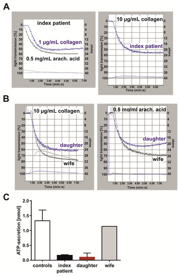 Novel GATA1 Variant Causing a Bleeding Phenotype Associated with ...