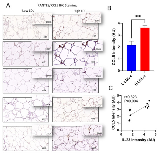 Increased Adipose Tissue Expression of IL-23 Associates with ...