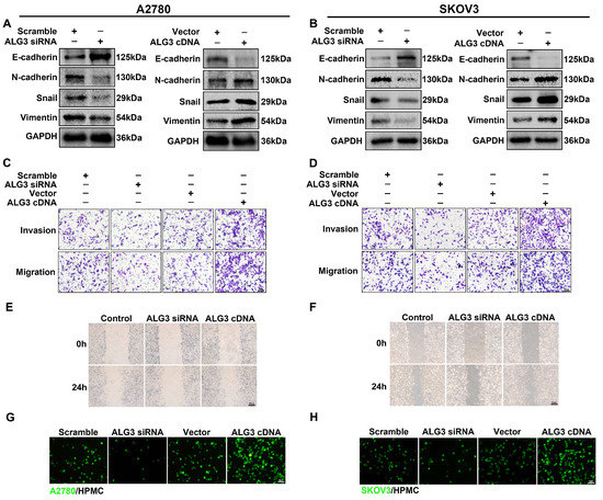 Cells | Free Full-Text | ALG3 Promotes Peritoneal Metastasis of Ovarian ...