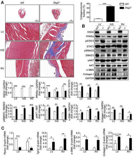 Activation of PPARα Ameliorates Cardiac Fibrosis in Dsg2-Deficient ...