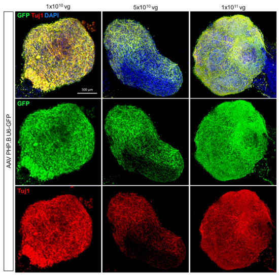 Efficient Gene Expression in Human Stem Cell Derived-Cortical Organoids ...