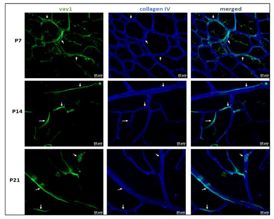 Hematopoietic Cells Influence Vascular Development in the Retina