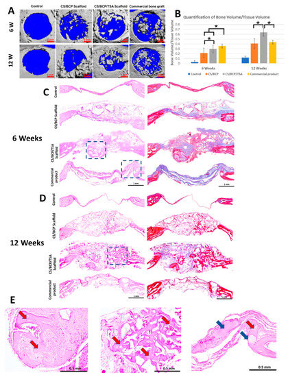 Novel Epigenetic Modulation Chitosan-Based Scaffold as a Promising Bone Regenerative Material