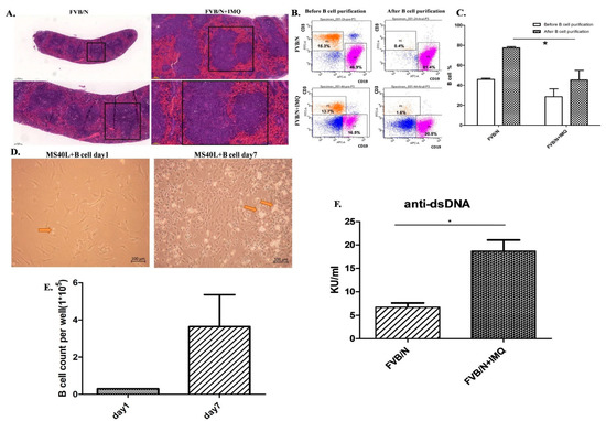 A Study on MDA5 Signaling in Splenic B Cells from an Imiquimod-Induced ...