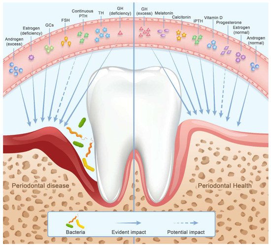 Osteoporosis and Alveolar Bone Health in Periodontitis Niche: A ...