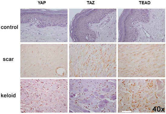 The Role of Hippo Signaling Pathway and ILK in the Pathophysiology of ...