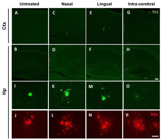 Altering Brain Amyloidosis by Intra-Lingual and Extra-Nasal Exposure of ...