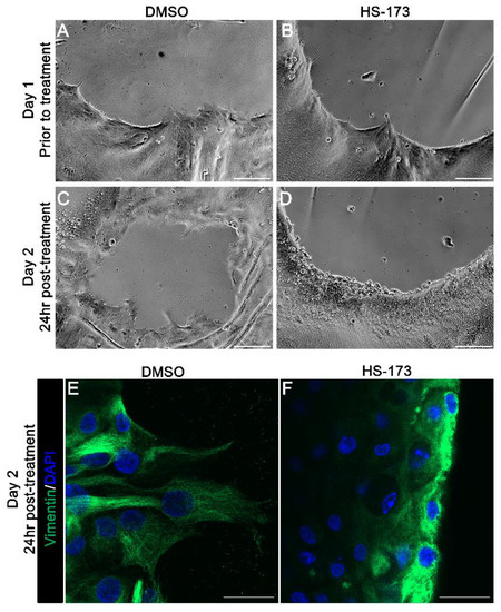 PI3K Isoform-Specific Regulation of Leader and Follower Cell Function ...
