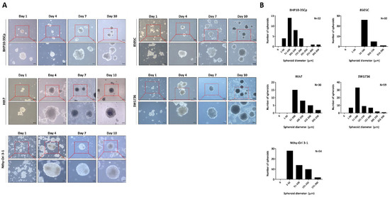 Different Expression of Thyroid-Specific Proteins in Thyroid Cancer ...