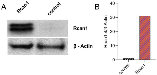 Overexpression of RCAN1, a Gene on Human Chromosome 21, Alters Cell ...
