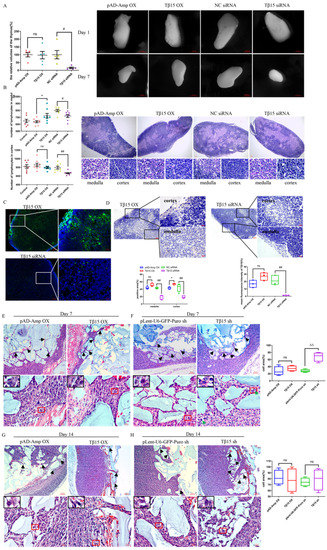 Thymosin Beta 15 Alters the Spatial Development of Thymic Epithelial Cells