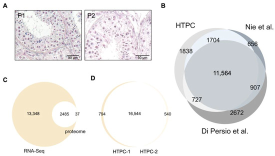 The Molecular Signature of Human Testicular Peritubular Cells Revealed ...
