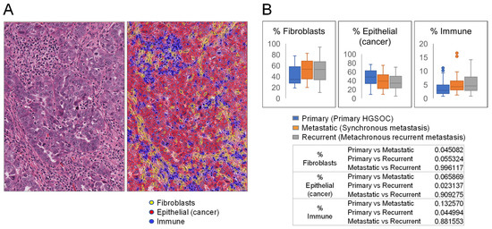 Dynamic Changes in the Extracellular Matrix in Primary, Metastatic, and Recurrent Ovarian Cancers