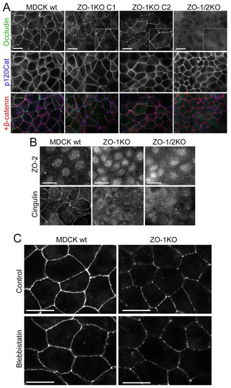 ZO-1 Guides Tight Junction Assembly and Epithelial Morphogenesis via ...