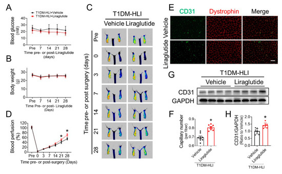 Liraglutide Improves the Angiogenic Capability of EPC and Promotes ...