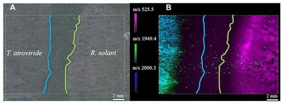 MALDI Mass Spectrometry Imaging: A Potential Game-Changer in a Modern ...