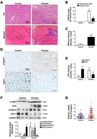Nucleophagic Degradation of Progerin Ameliorates Defenestration in ...