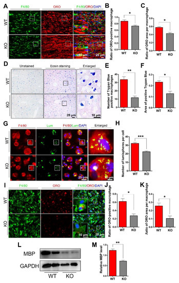 miR-301a Deficiency Attenuates the Macrophage Migration and ...