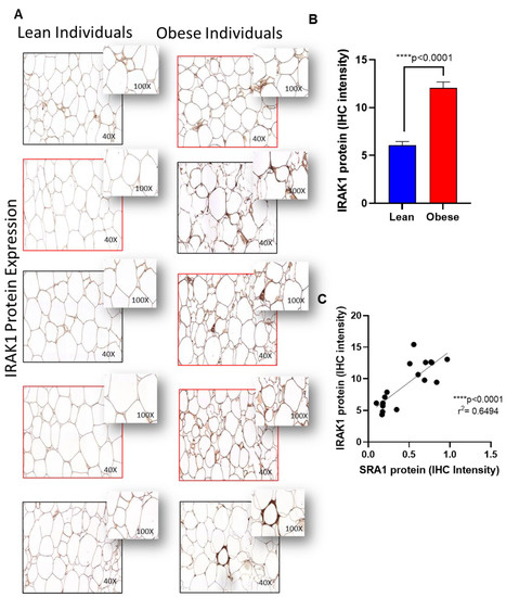 Expression of Steroid Receptor RNA Activator 1 (SRA1) in the Adipose ...