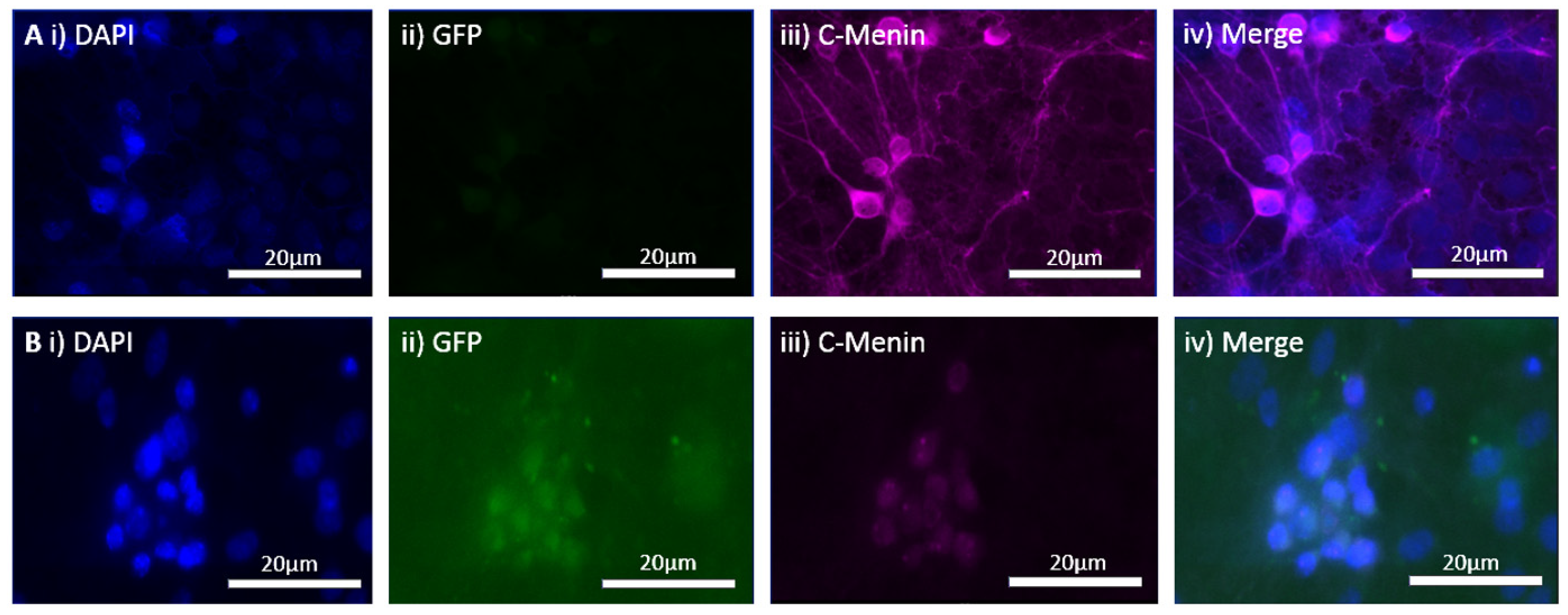 Selective Menin Deletion in the Hippocampal CA1 Region Leads to ...