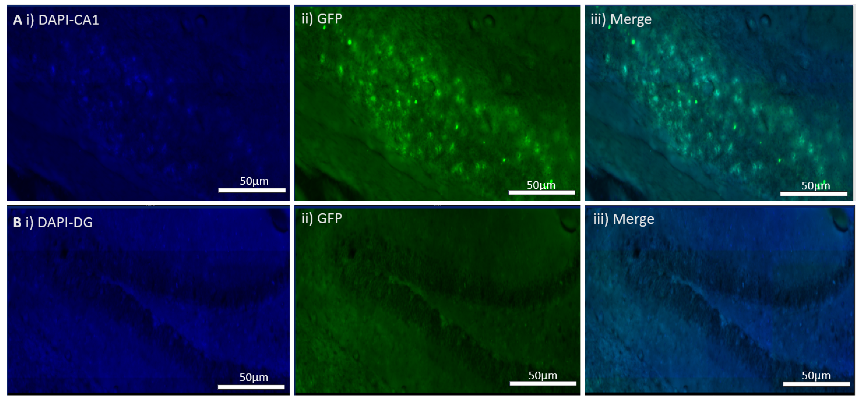 Selective Menin Deletion in the Hippocampal CA1 Region Leads to ...