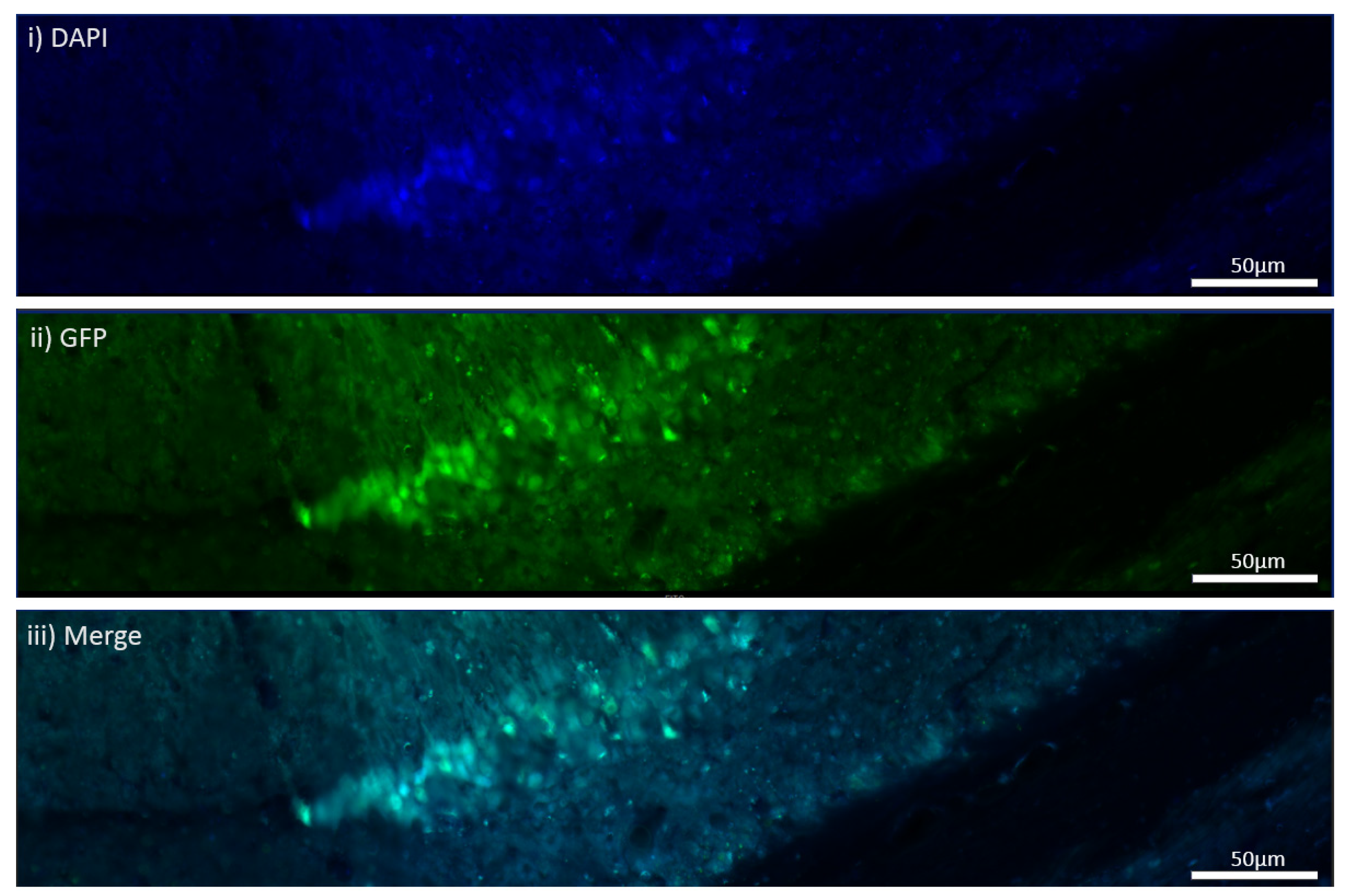 Selective Menin Deletion in the Hippocampal CA1 Region Leads to ...