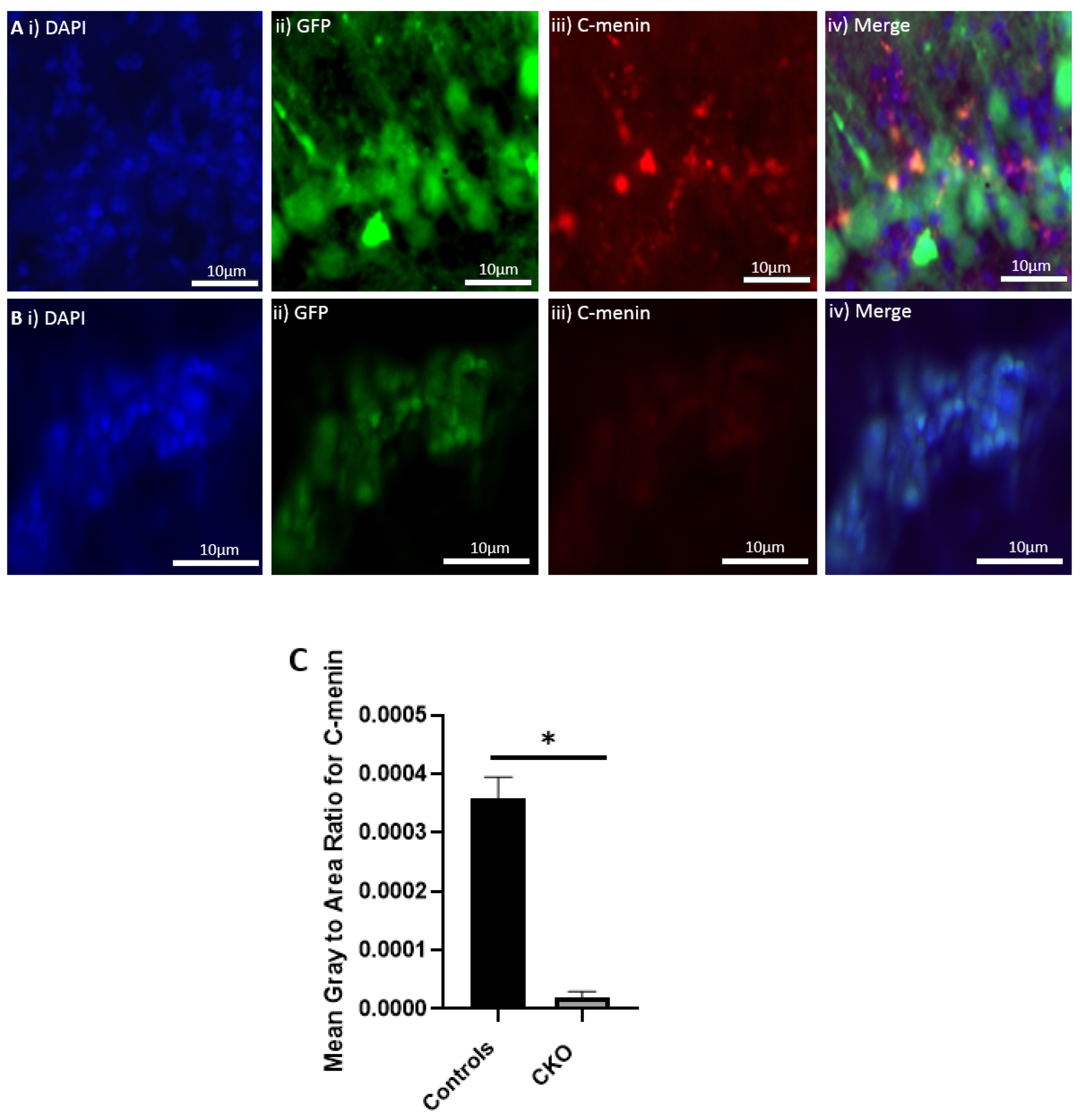 Selective Menin Deletion in the Hippocampal CA1 Region Leads to ...