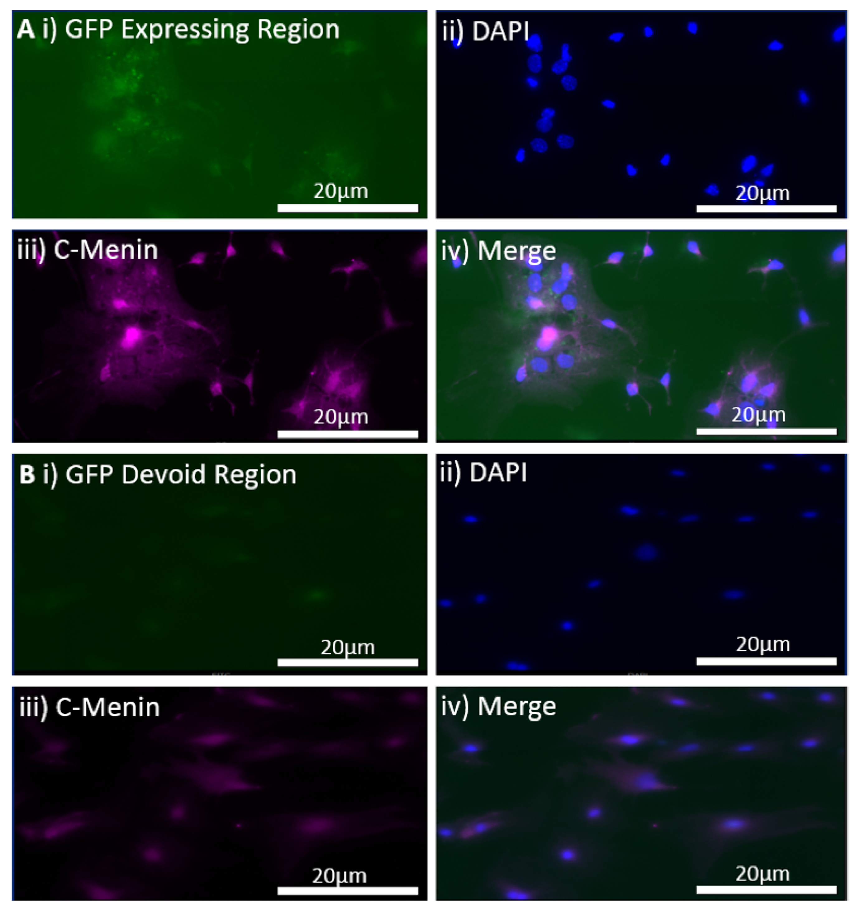 Selective Menin Deletion in the Hippocampal CA1 Region Leads to ...
