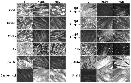 Cells | Free Full-Text | RNA-Seq of Dermal Fibroblasts from Patients with Hypermobile Ehlers ...