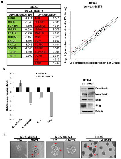 MST4: A Potential Oncogene and Therapeutic Target in Breast Cancer
