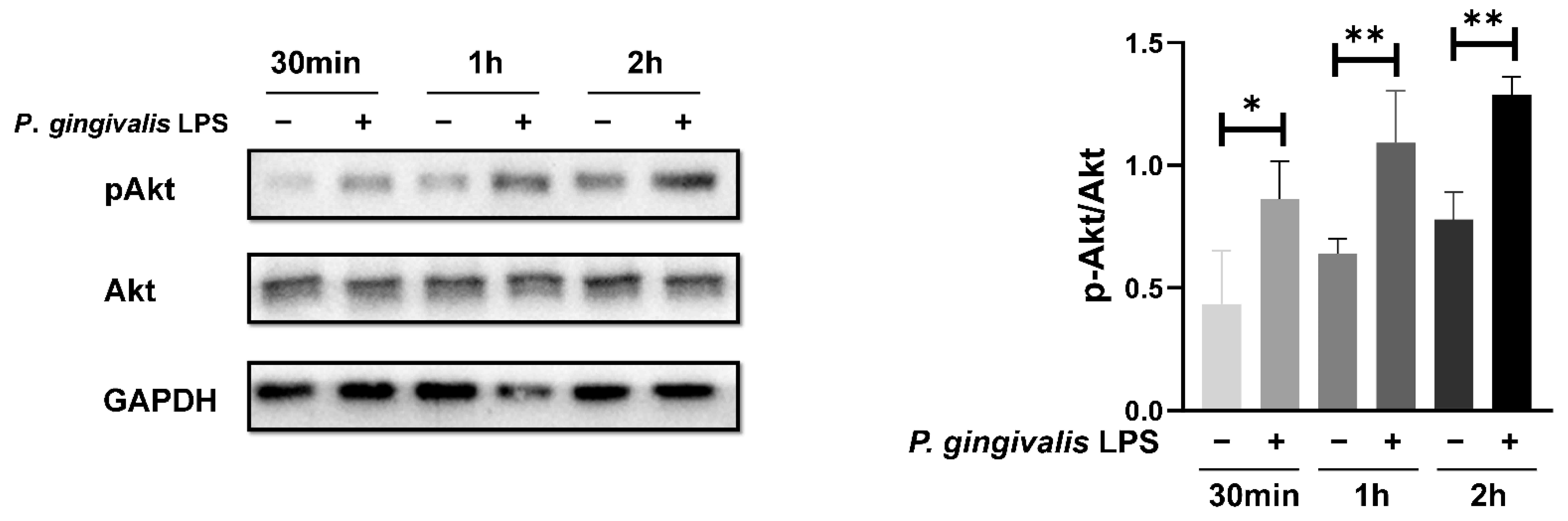Cells Free Full Text Porphyromonas Gingivalis Derived
