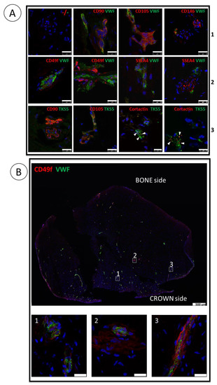 The Journey of SCAPs (Stem Cells from Apical Papilla), from Their ...