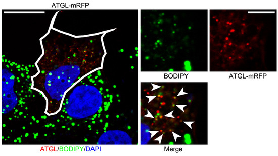 PNPLA3(I148M) Inhibits Lipolysis by Perilipin-5-Dependent Competition ...