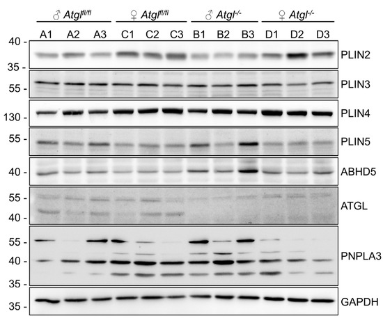 PNPLA3(I148M) Inhibits Lipolysis by Perilipin-5-Dependent Competition ...
