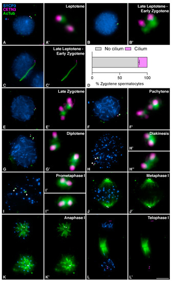 The Male Mouse Meiotic Cilium Emanates from the Mother Centriole at ...