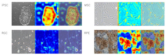 Recognizing the Differentiation Degree of Human Induced Pluripotent Stem Cell-Derived Retinal ...