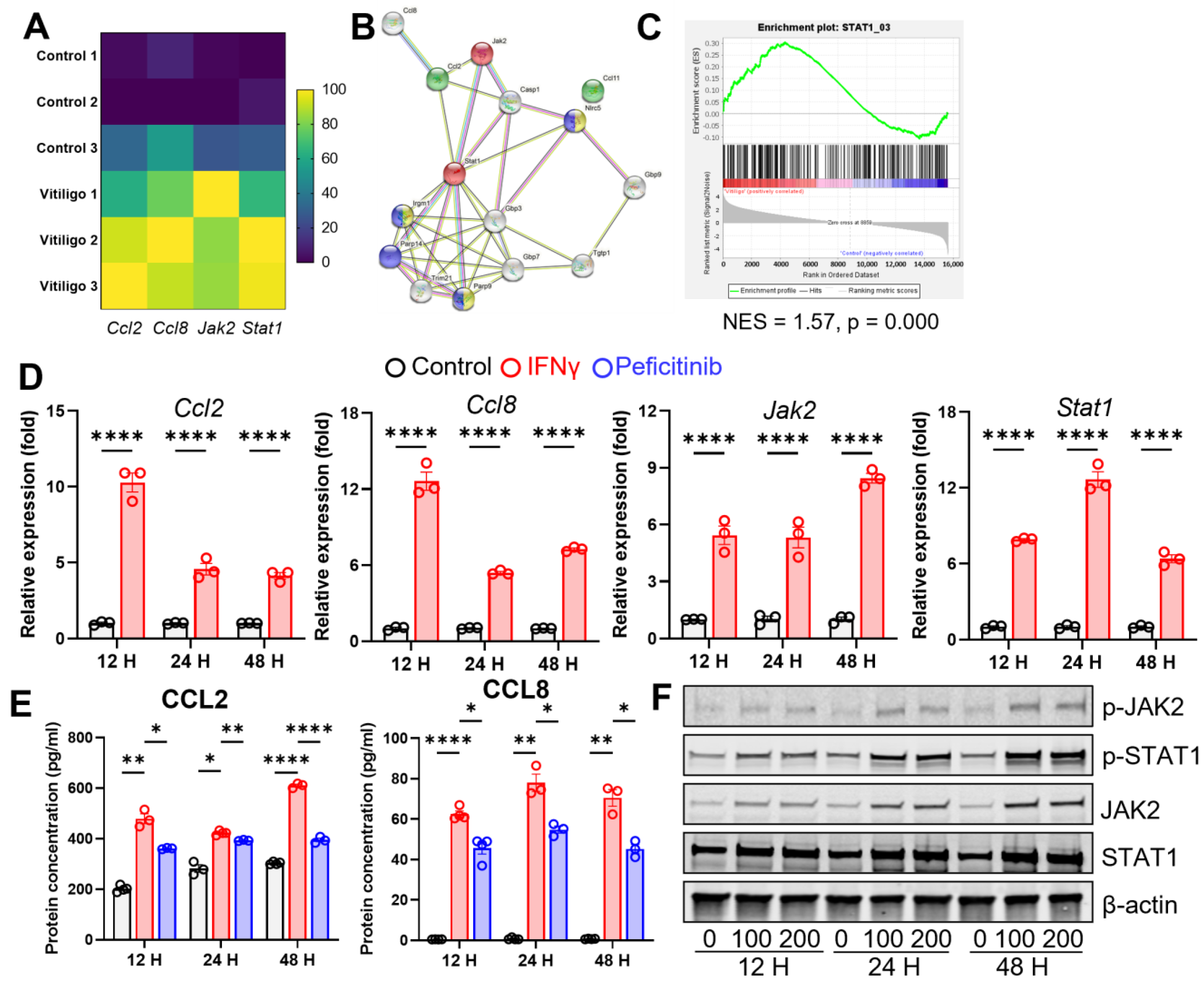 Pathogenic Th2 Cytokine Profile Skewing by IFN-γ-Responding Vitiligo ...