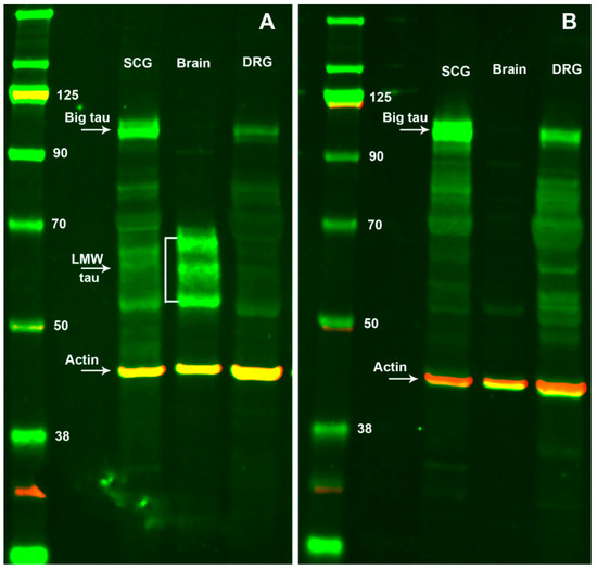 Regulation of Tau Expression in Superior Cervical Ganglion (SCG ...