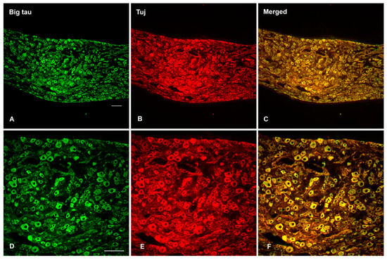 Regulation of Tau Expression in Superior Cervical Ganglion (SCG ...