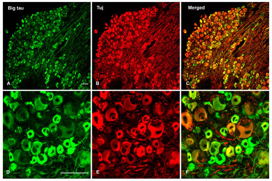 Regulation of Tau Expression in Superior Cervical Ganglion (SCG ...