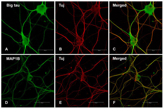 Regulation of Tau Expression in Superior Cervical Ganglion (SCG ...