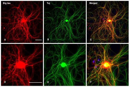 Regulation of Tau Expression in Superior Cervical Ganglion (SCG ...