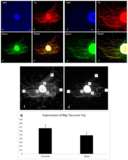 Regulation of Tau Expression in Superior Cervical Ganglion (SCG ...