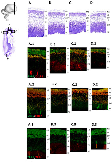 Early Regional Patterning in the Human Prefrontal Cortex Revealed by ...