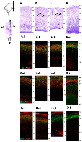Early Regional Patterning in the Human Prefrontal Cortex Revealed by ...