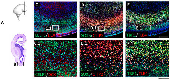 Early Regional Patterning in the Human Prefrontal Cortex Revealed by ...